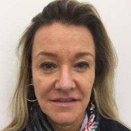 Blepharoplasty Before & After Pictures - Eyelid Reduction | London, UK