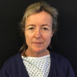Blepharoplasty Before & After Pictures - Eyelid Reduction | London, UK