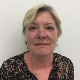 Blepharoplasty Before & After Pictures - Eyelid Reduction | London, UK